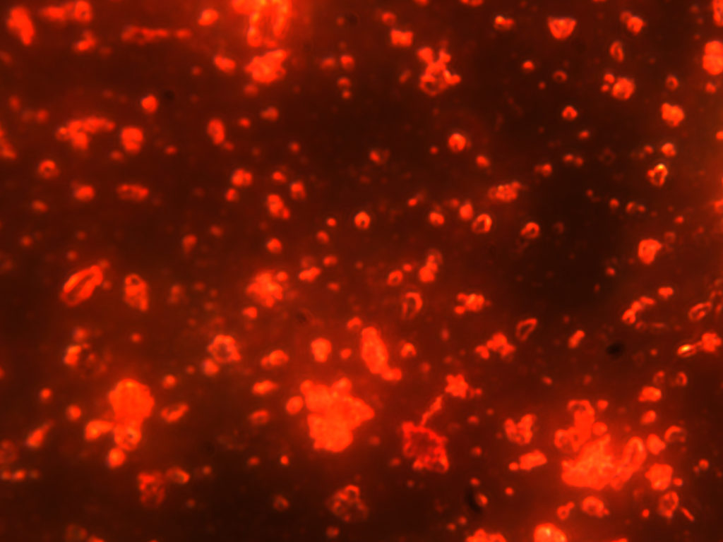 Leica DM4000 B Digital Automated Transmitted Light Axis Microscope ...