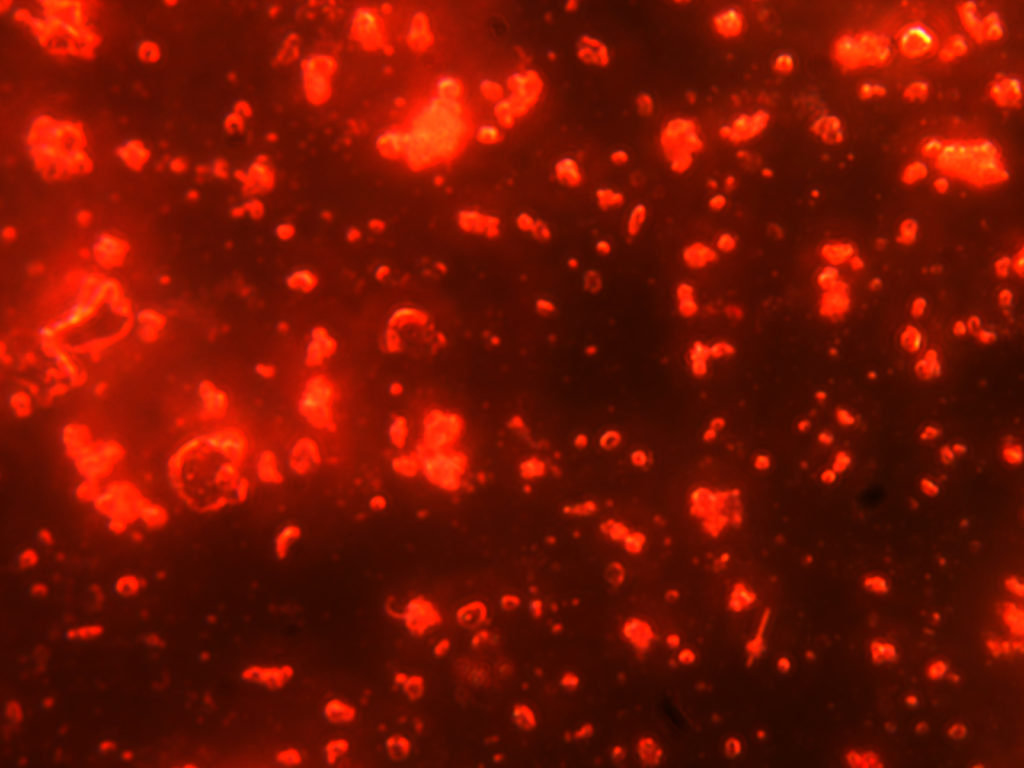 Leica DM4000 B Digital Automated Transmitted Light Axis Microscope ...